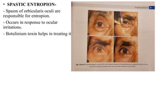 ENTROPION in detailed analysis and management | PPTX