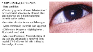 ENTROPION in detailed analysis and management | PPTX