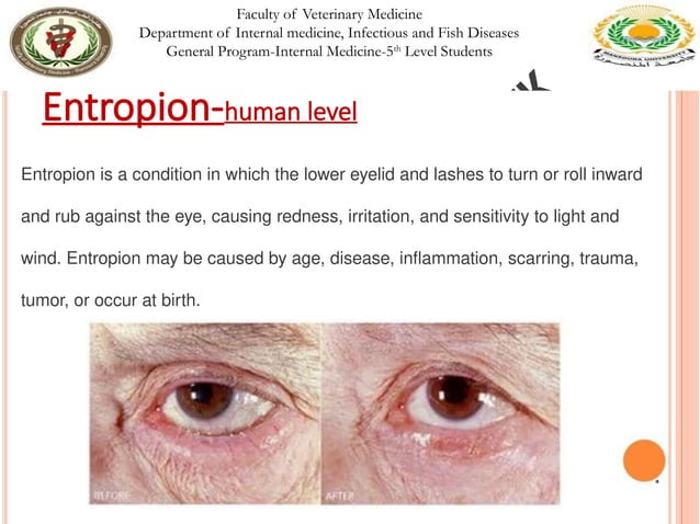 entropion, ectropion, and cherry eye.pptx