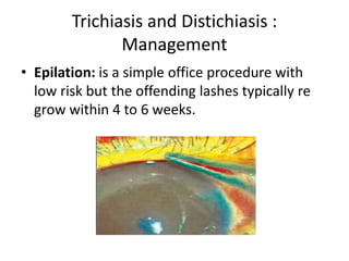 Entropion ectropion and ptosis repair | PPTX