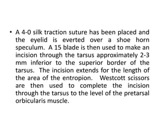 Entropion ectropion and ptosis repair | PPTX