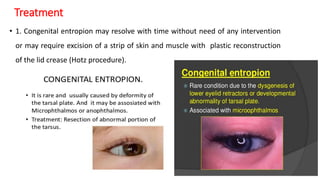 Entropion o.a claa 2nd year | PPTX