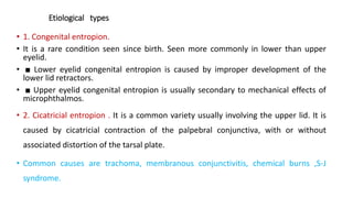 Entropion o.a claa 2nd year | PPTX