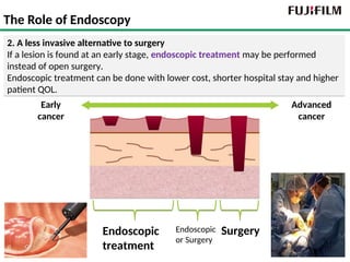What is Endoscopy? (Flexible Endoscopes) | PPT