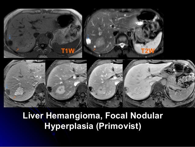 Entry level diagnosis of abdomen MRI