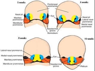 ENT about DEVELOPMENT OF NOSE | PPTX