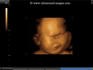 ENT about DEVELOPMENT OF NOSE | PPTX
