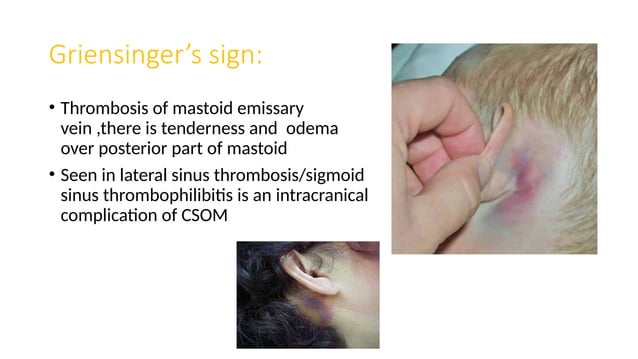 ENT sign and triades by Dr.Muhammad Sherwani.pptx