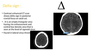 ENT sign and triades by Dr.Muhammad Sherwani.pptx