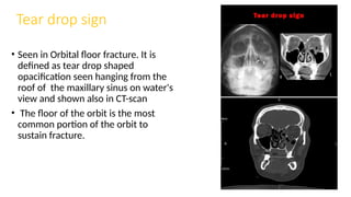 ENT sign and triades by Dr.Muhammad Sherwani.pptx