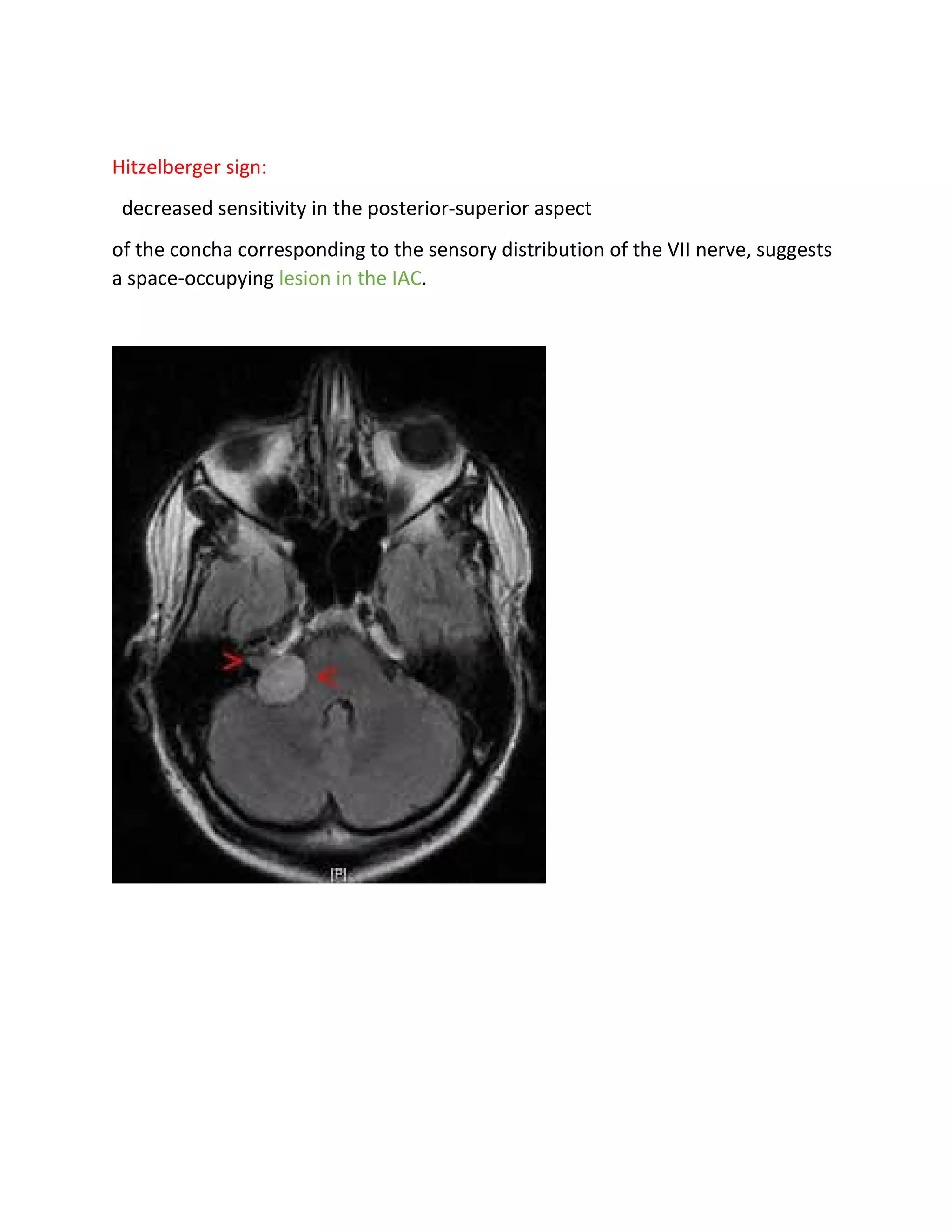 Ent signs by yassin hasan | PDF