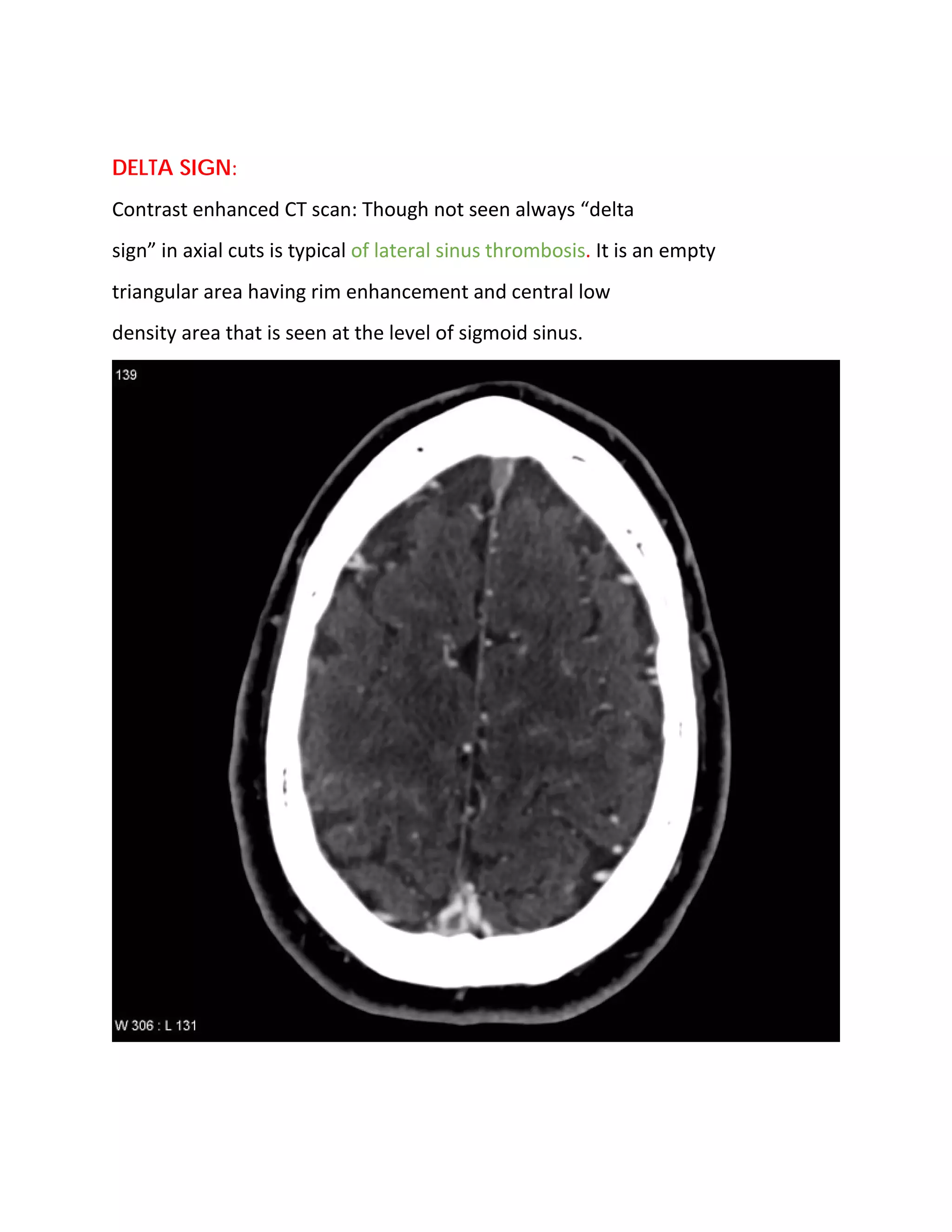 Ent signs by yassin hasan | PDF