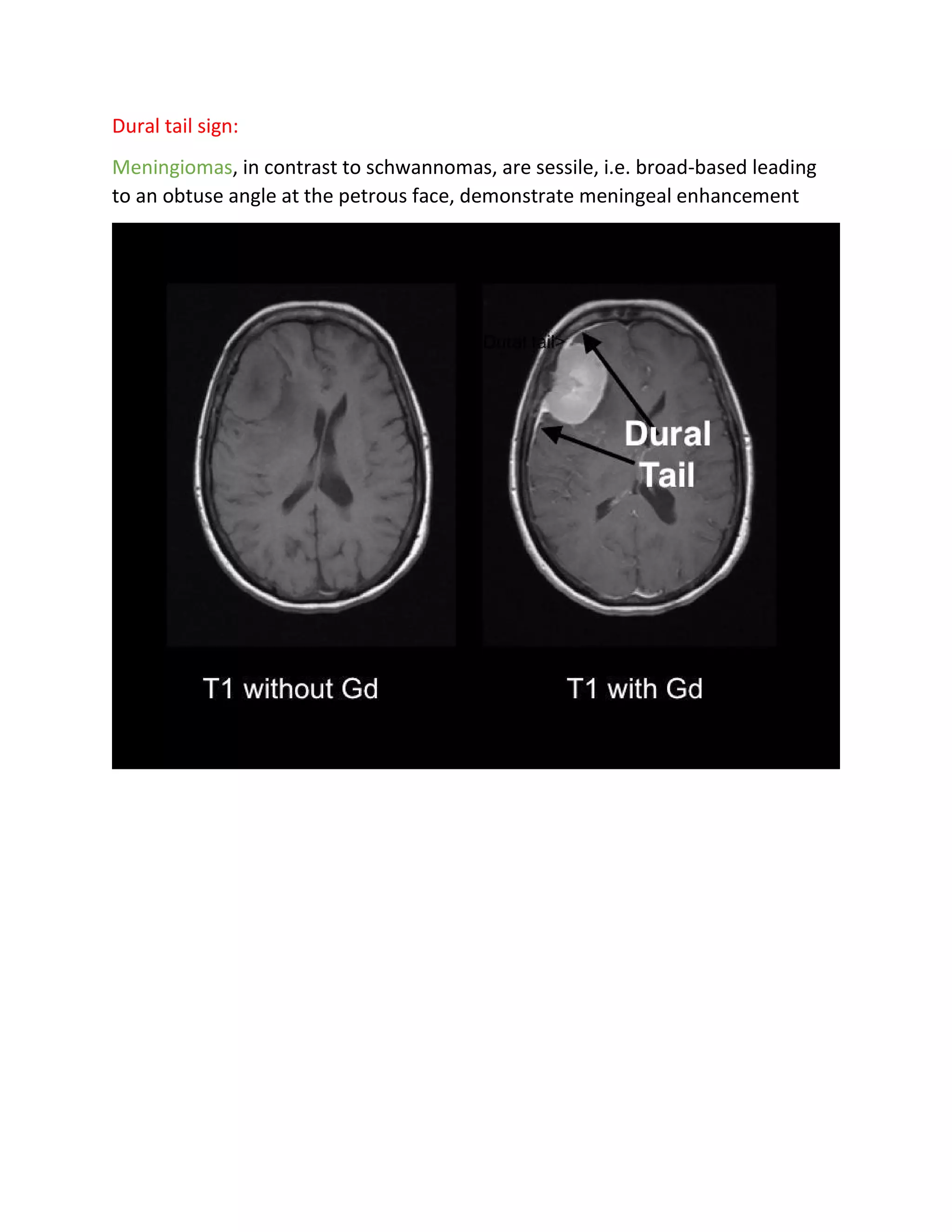 Ent signs by yassin hasan | PDF