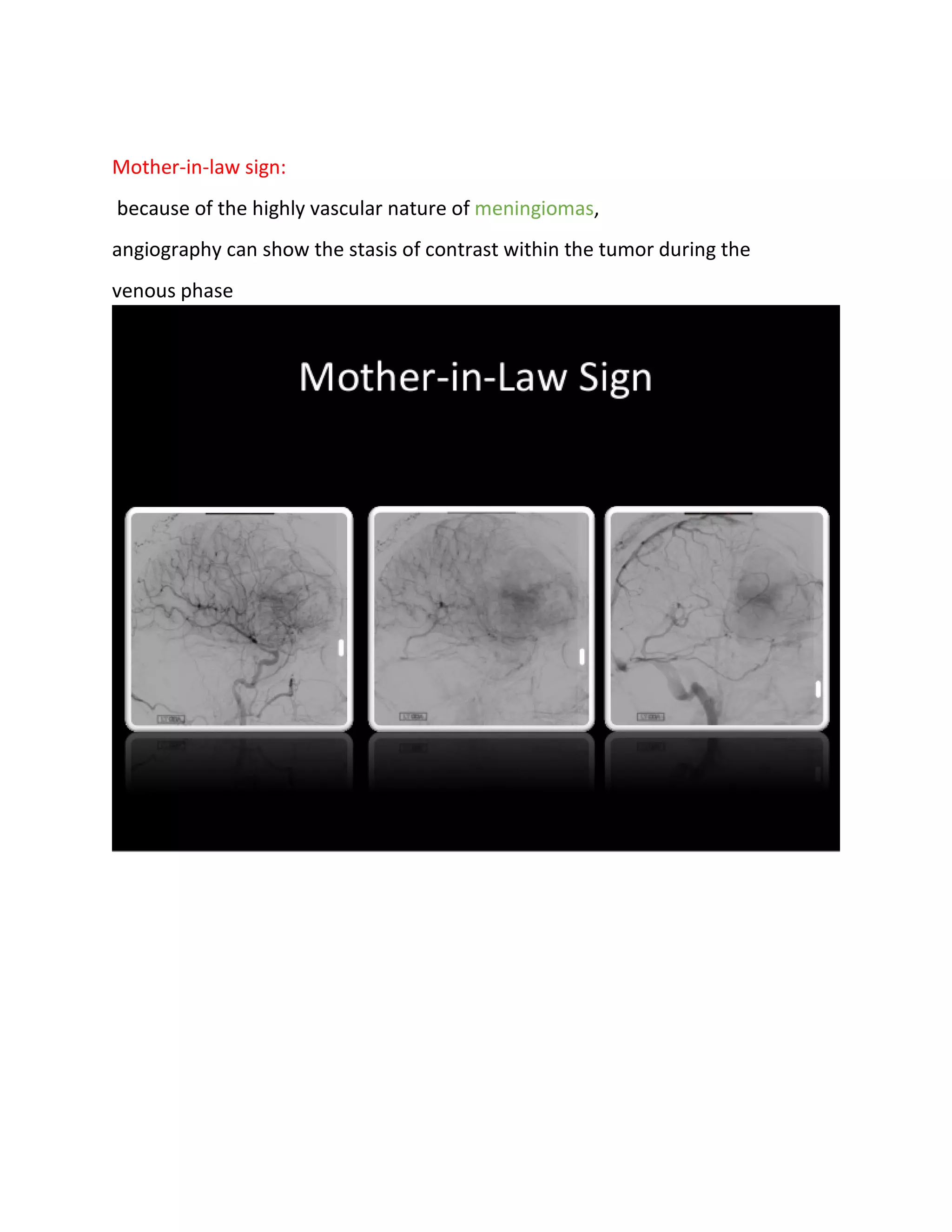 Ent signs by yassin hasan | PDF