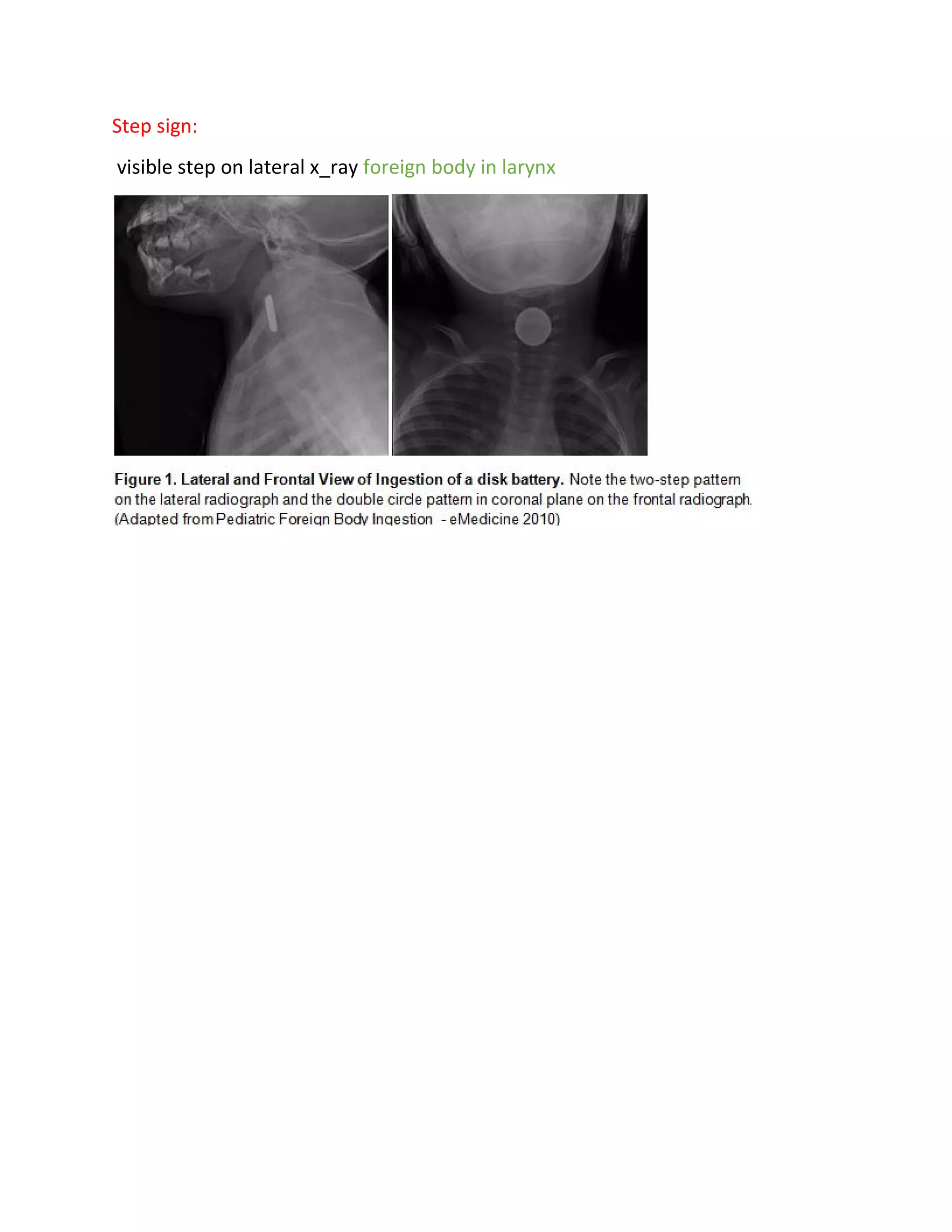 Ent signs by yassin hasan | PDF