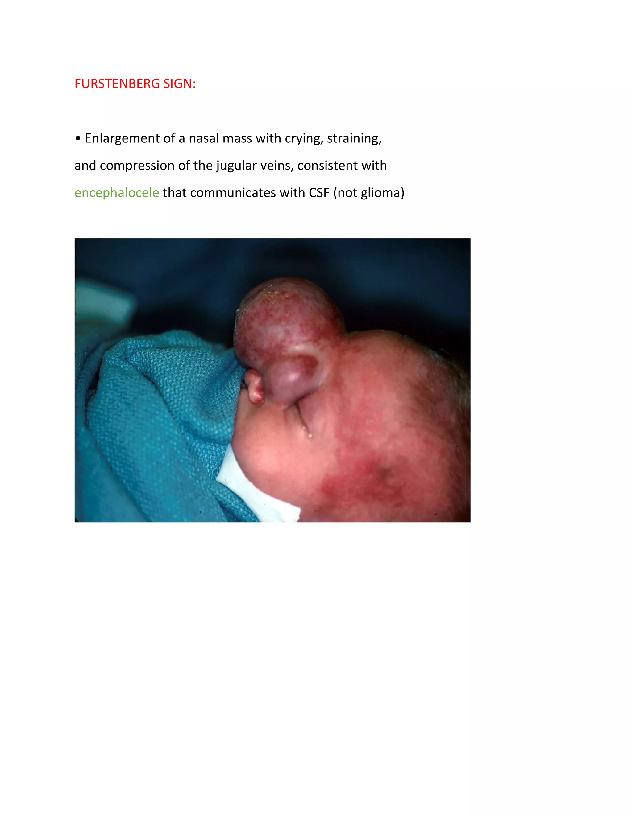 Ent signs by yassin hasan | PDF