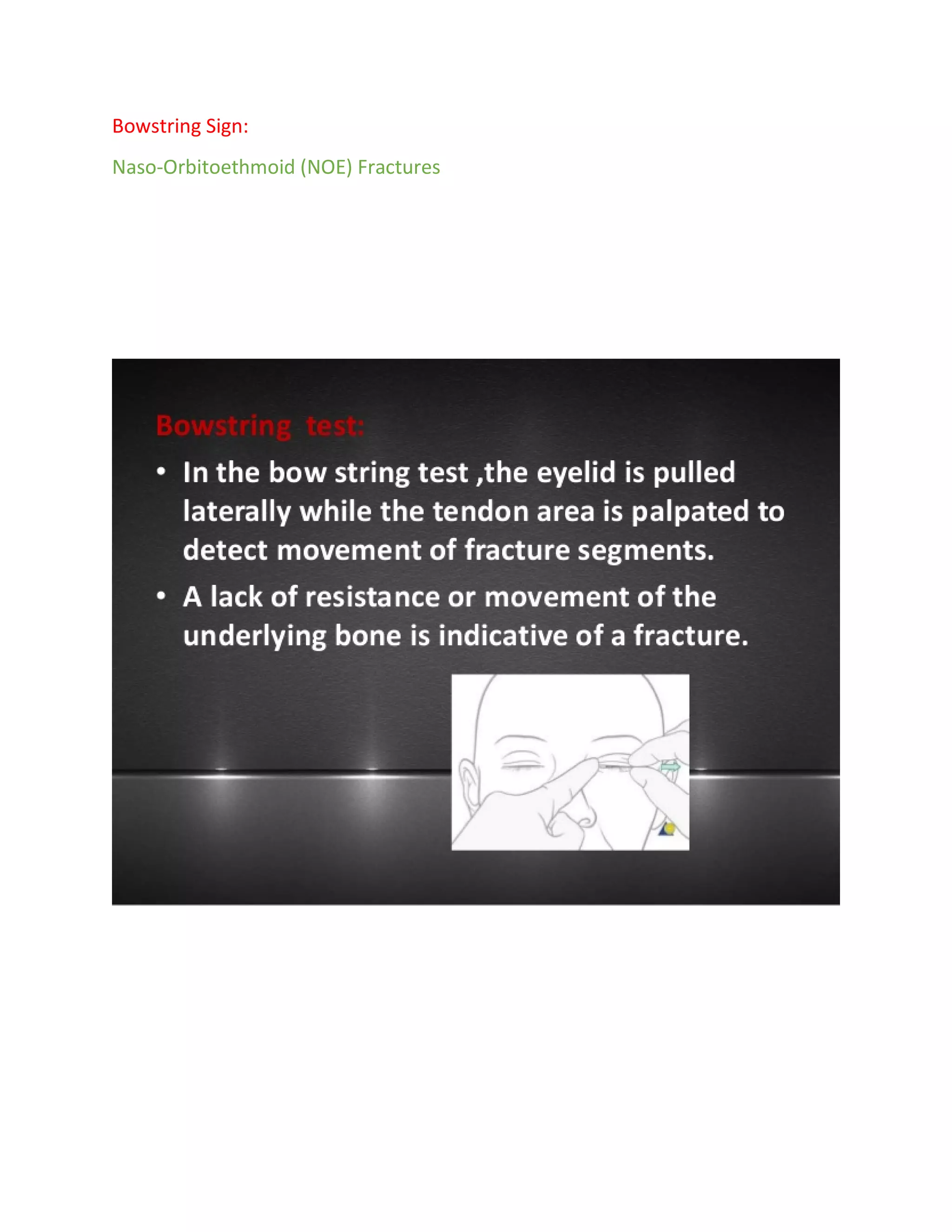 Ent signs by yassin hasan | PDF