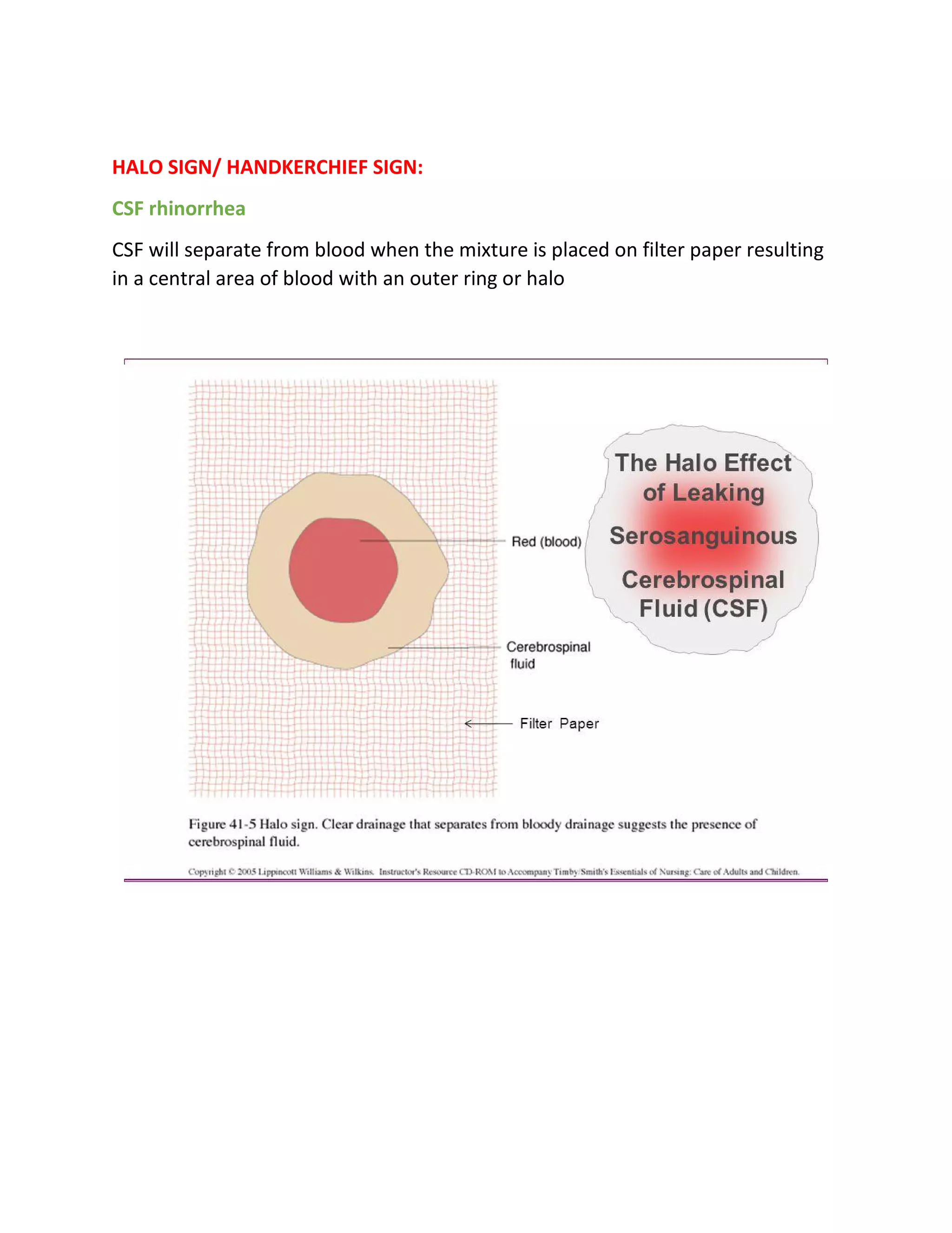 Ent signs by yassin hasan | PDF