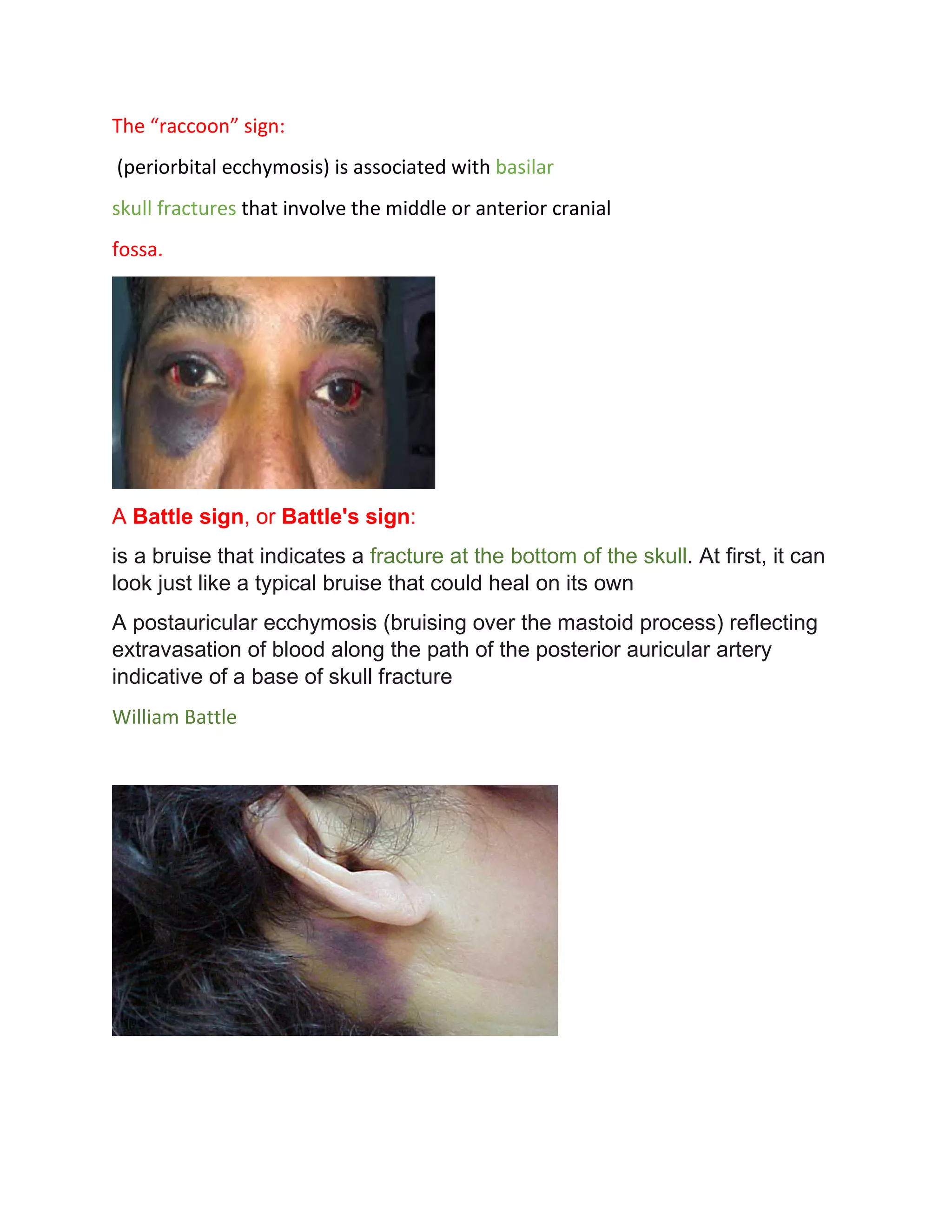 Ent signs by yassin hasan | PDF