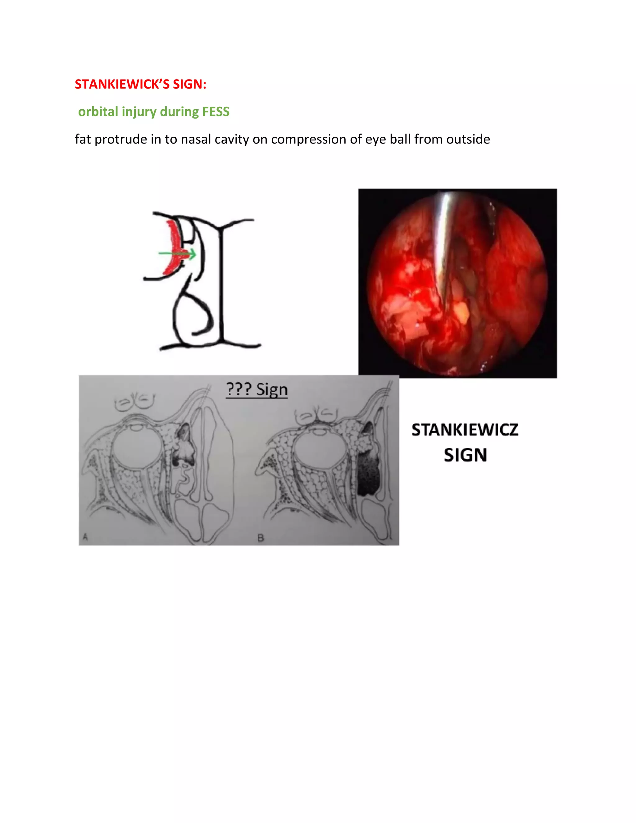 Ent signs by yassin hasan | PDF