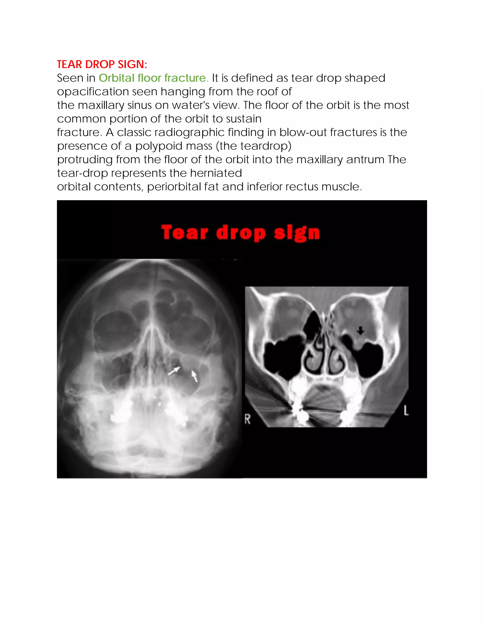 Ent signs by yassin hasan | PDF
