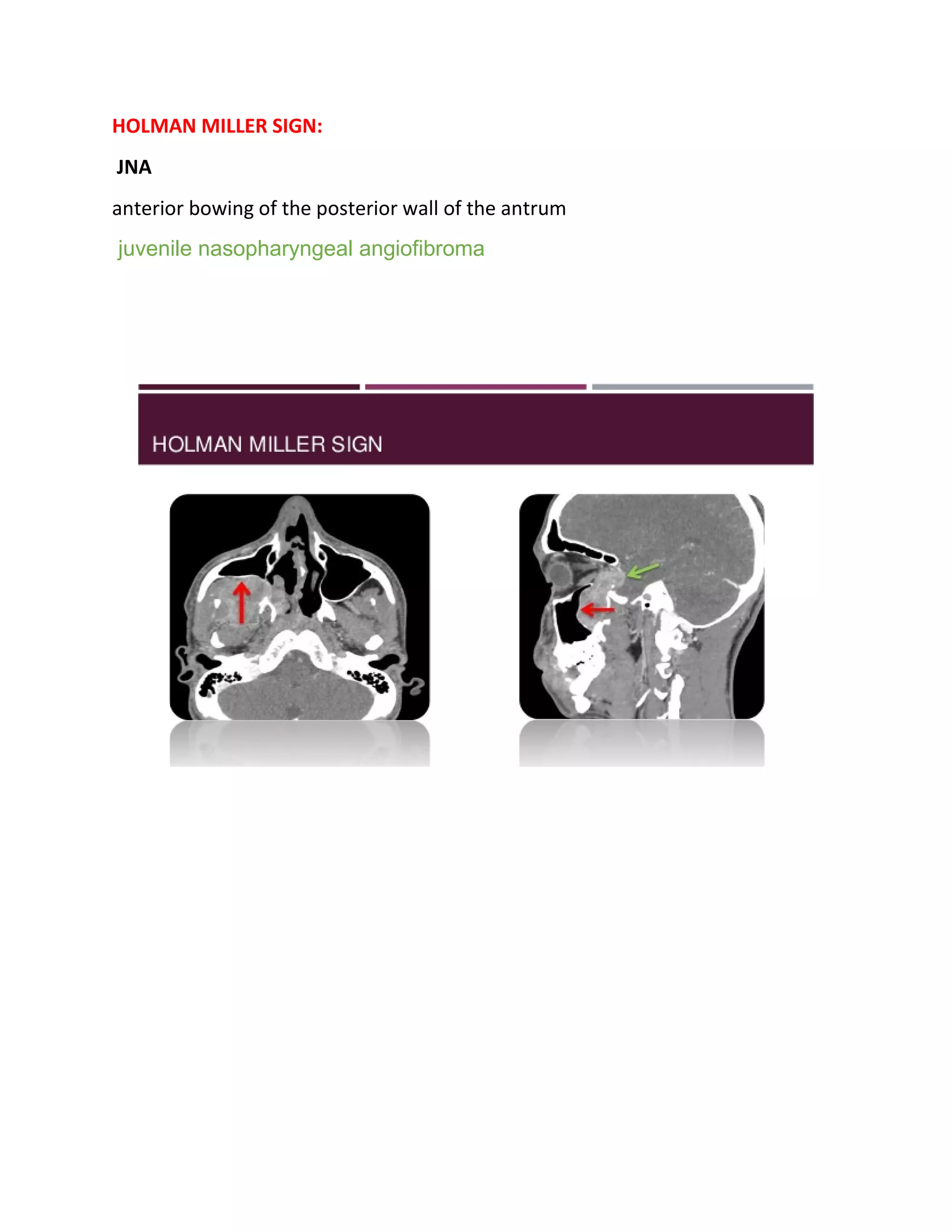 Ent signs by yassin hasan | PDF