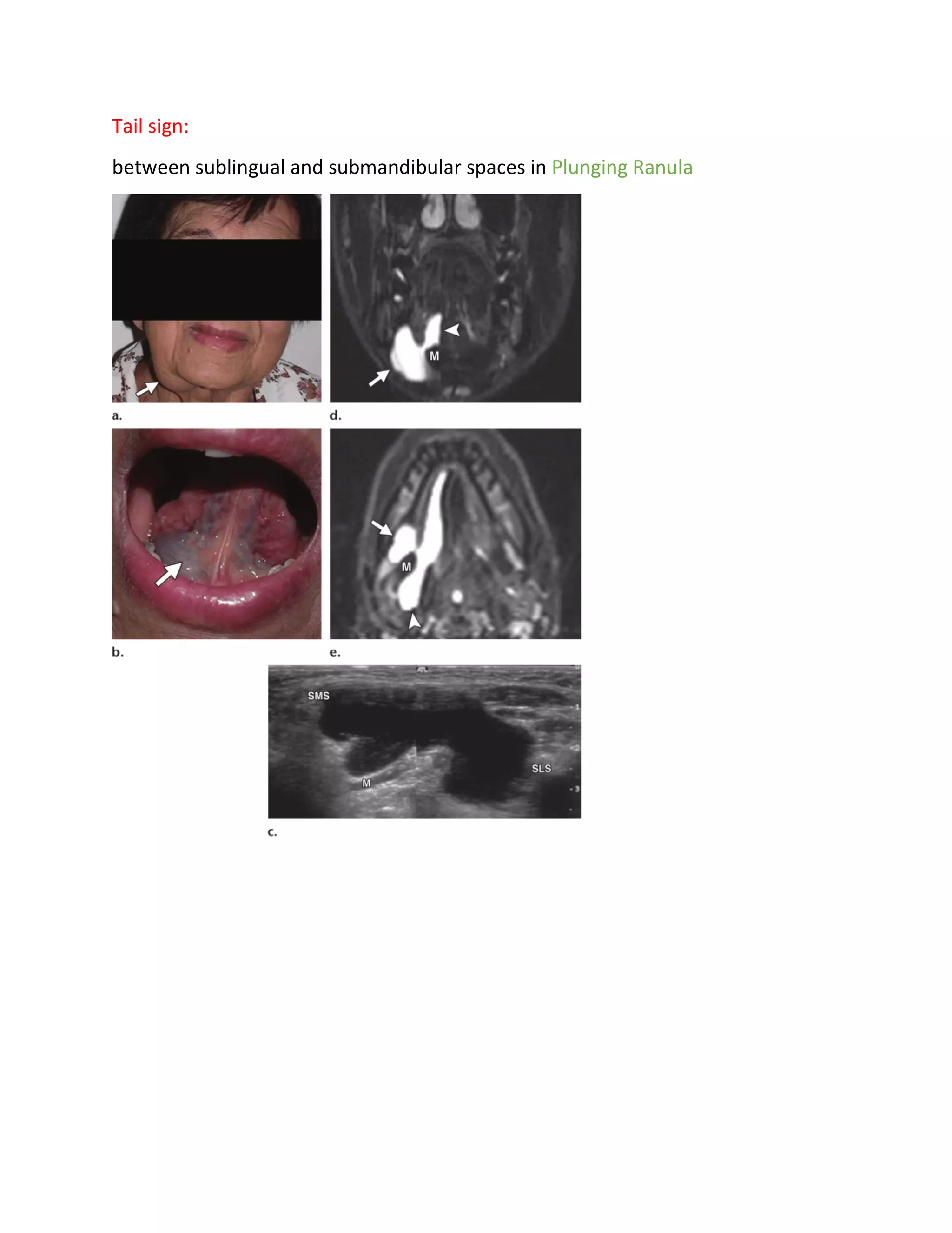Ent signs by yassin hasan | PDF