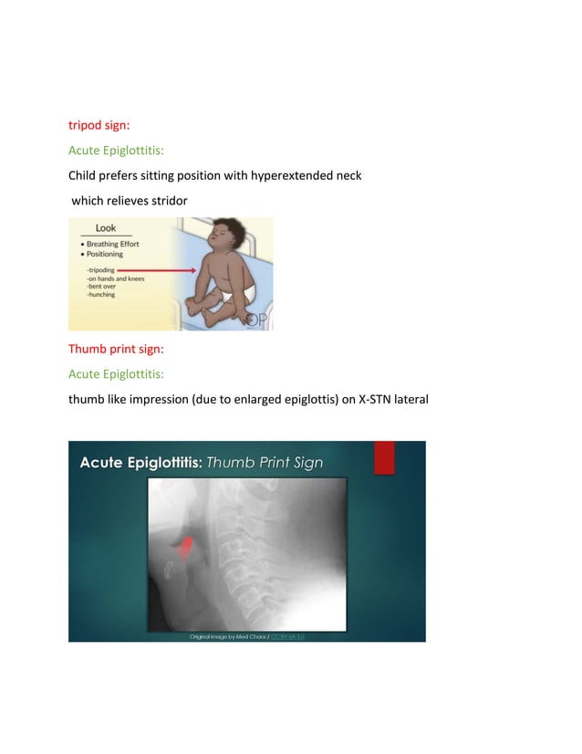 Ent signs by yassin hasan | PDF | Death, Injury, or Military Conflict ...