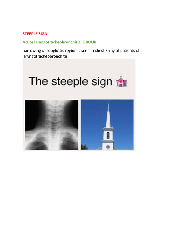 Ent signs by yassin hasan | PDF | Death, Injury, or Military Conflict ...
