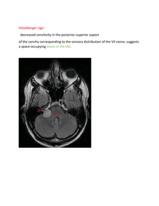 Ent signs by yassin hasan | PDF
