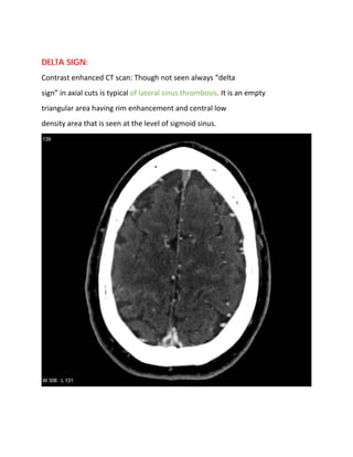 Ent signs by yassin hasan | PDF