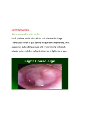 Ent signs by yassin hasan | PDF