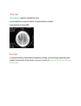 Ent signs by yassin hasan | PDF