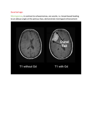 Ent signs by yassin hasan | PDF