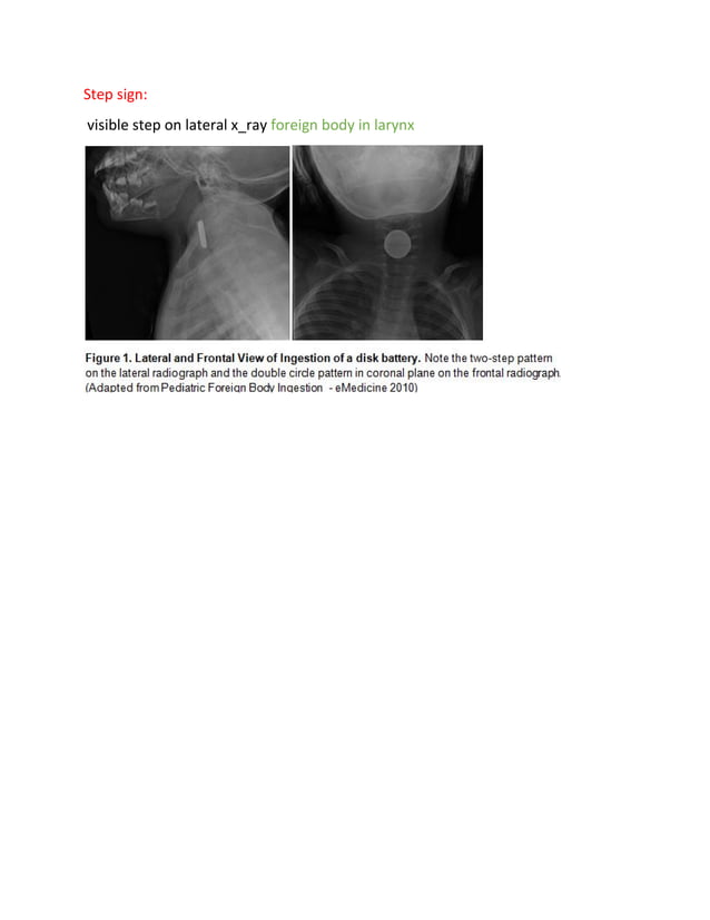 Ent signs by yassin hasan | PDF | Death, Injury, or Military Conflict ...