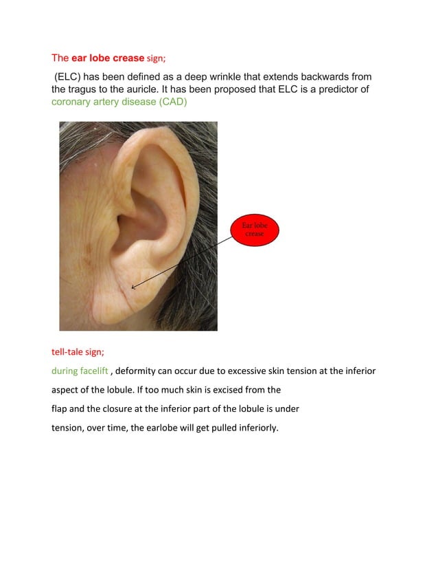 Ent signs by yassin hasan | PDF | Death, Injury, or Military Conflict ...