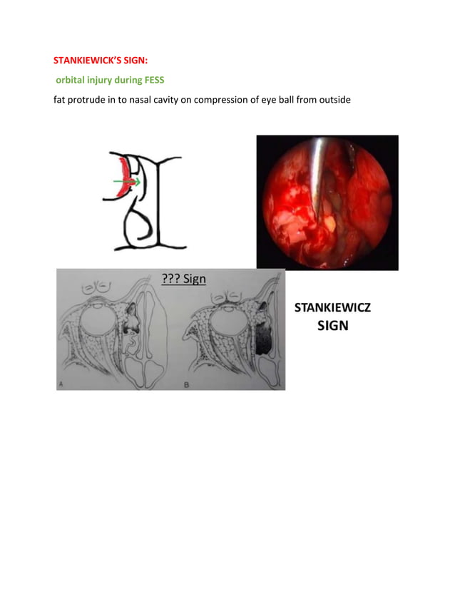 Ent signs by yassin hasan | PDF | Death, Injury, or Military Conflict ...