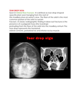 Ent signs by yassin hasan | PDF