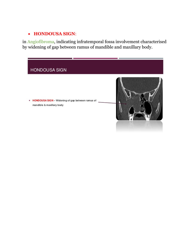 Ent signs by yassin hasan | PDF | Death, Injury, or Military Conflict ...