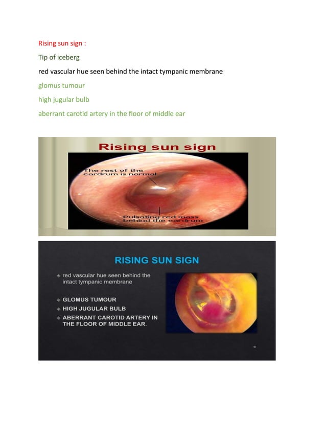 Ent signs by yassin hasan | PDF | Death, Injury, or Military Conflict ...