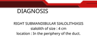 ENT Submandibular Sialolith of human body.pptx