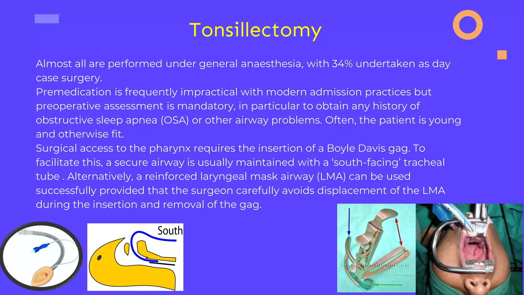 anaesthesia consideration for Ent surgery | PDF