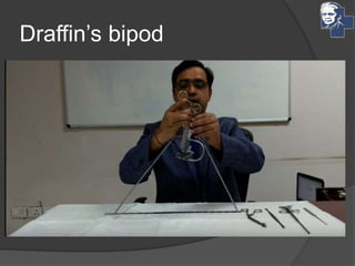 Management of Tonsillitis - Steps of tonsillectomy | PPTX