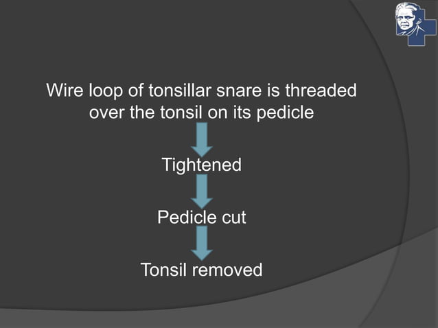 Management of Tonsillitis - Steps of tonsillectomy | PPTX