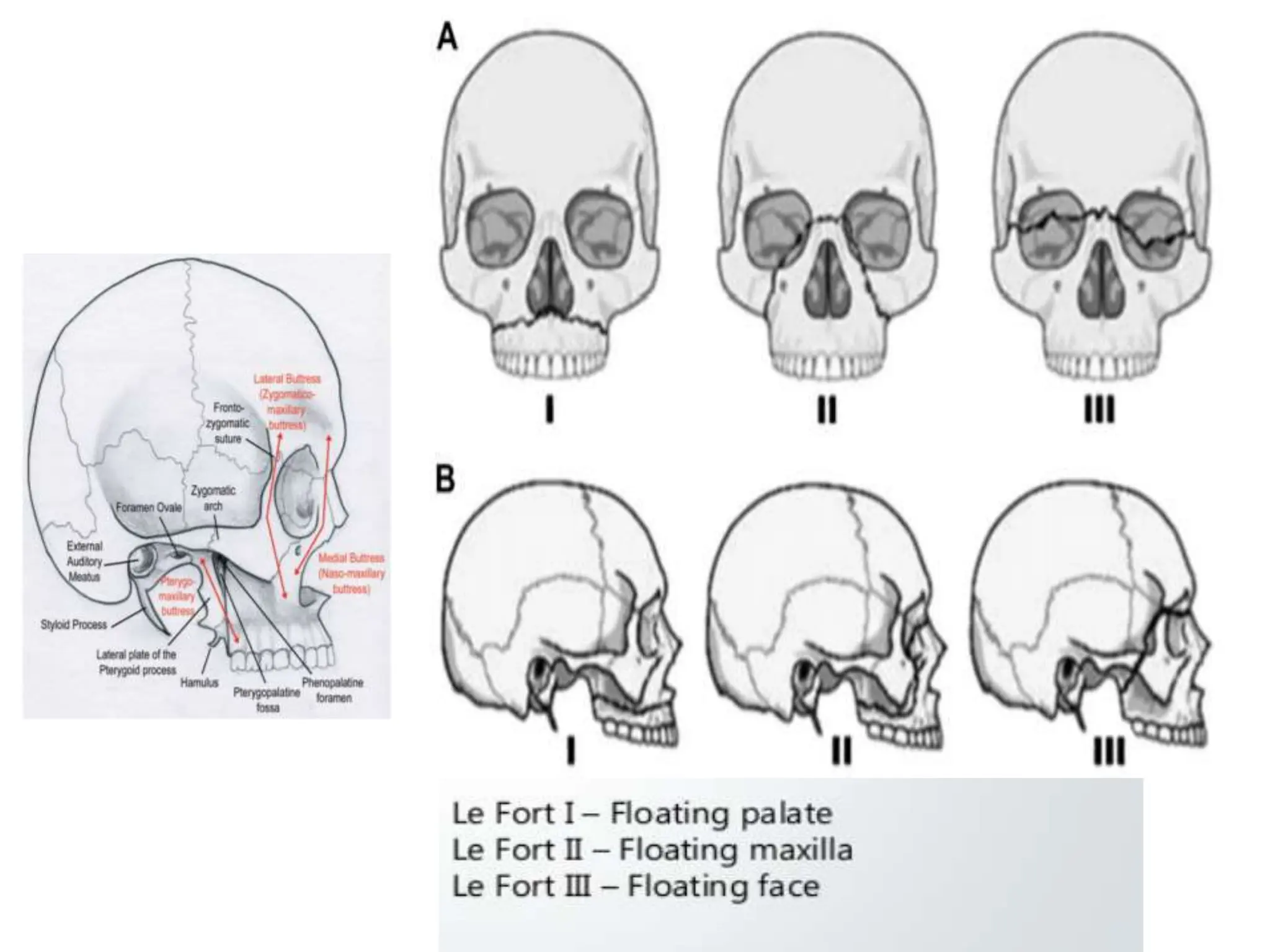 Facial Trauma and Neck Trauma Points.pptx