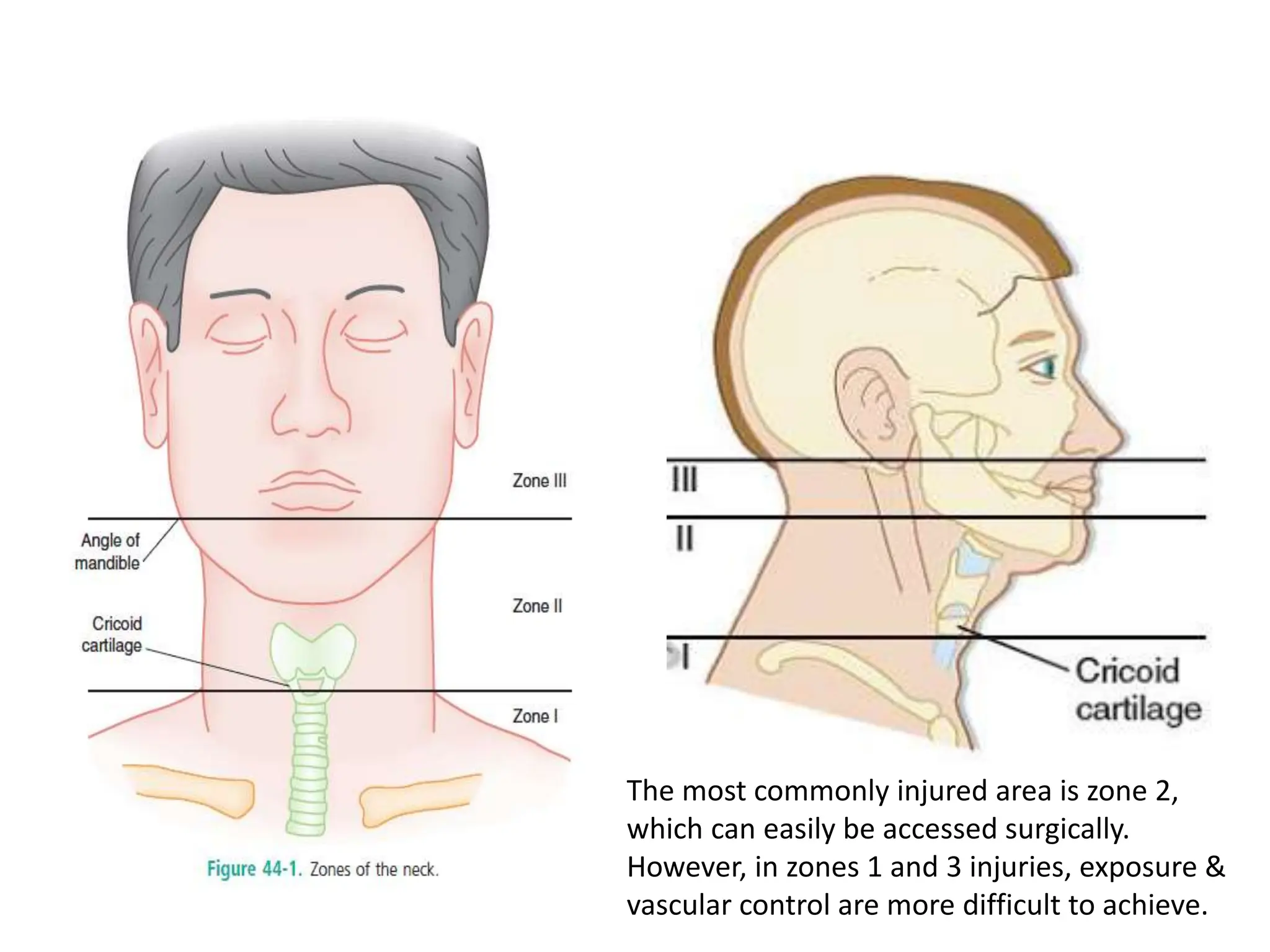 Facial Trauma and Neck Trauma Points.pptx