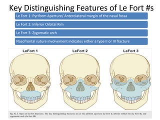 Facial Trauma and Neck Trauma Points.pptx