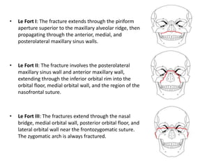 Facial Trauma and Neck Trauma Points.pptx