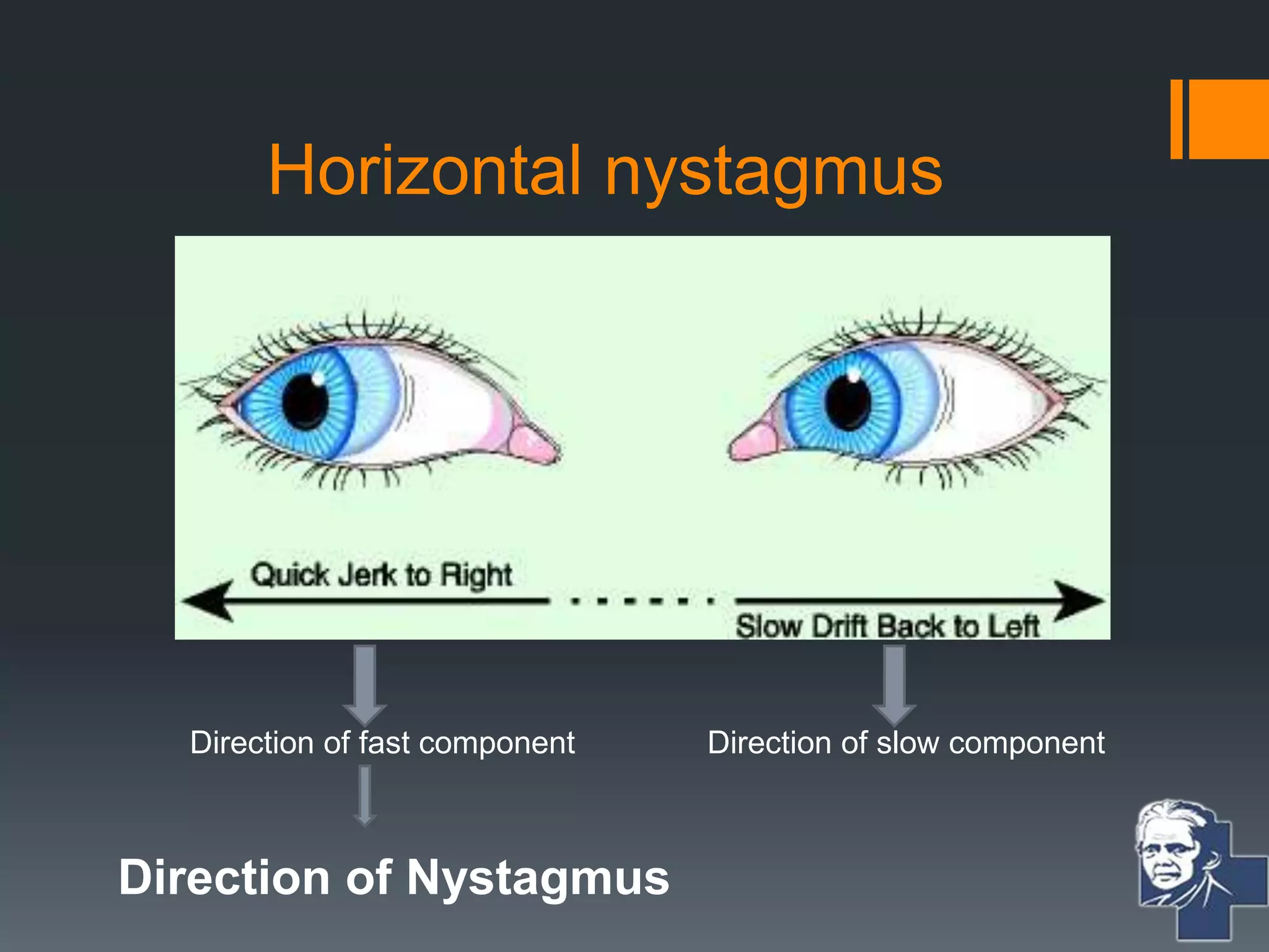 Vestibular Function Test | PPTX