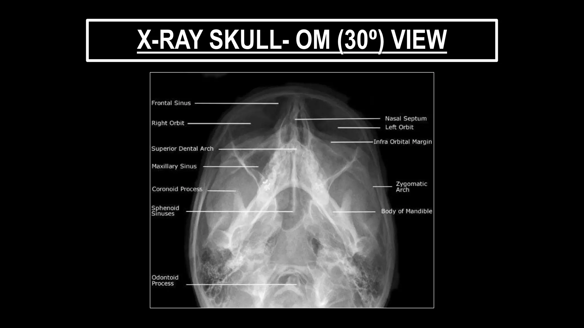 ENT X-RAYS | PPTX